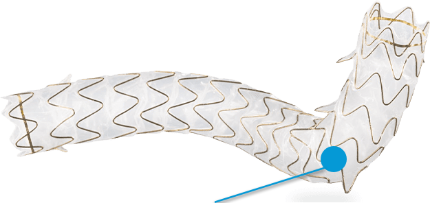 Maximize Control with GORE VIABIL | CONMED