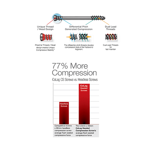 CoLag Compression Screws | CONMED