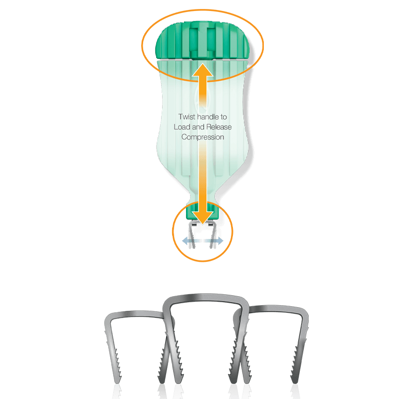 NeoSpan Compression Staples | CONMED