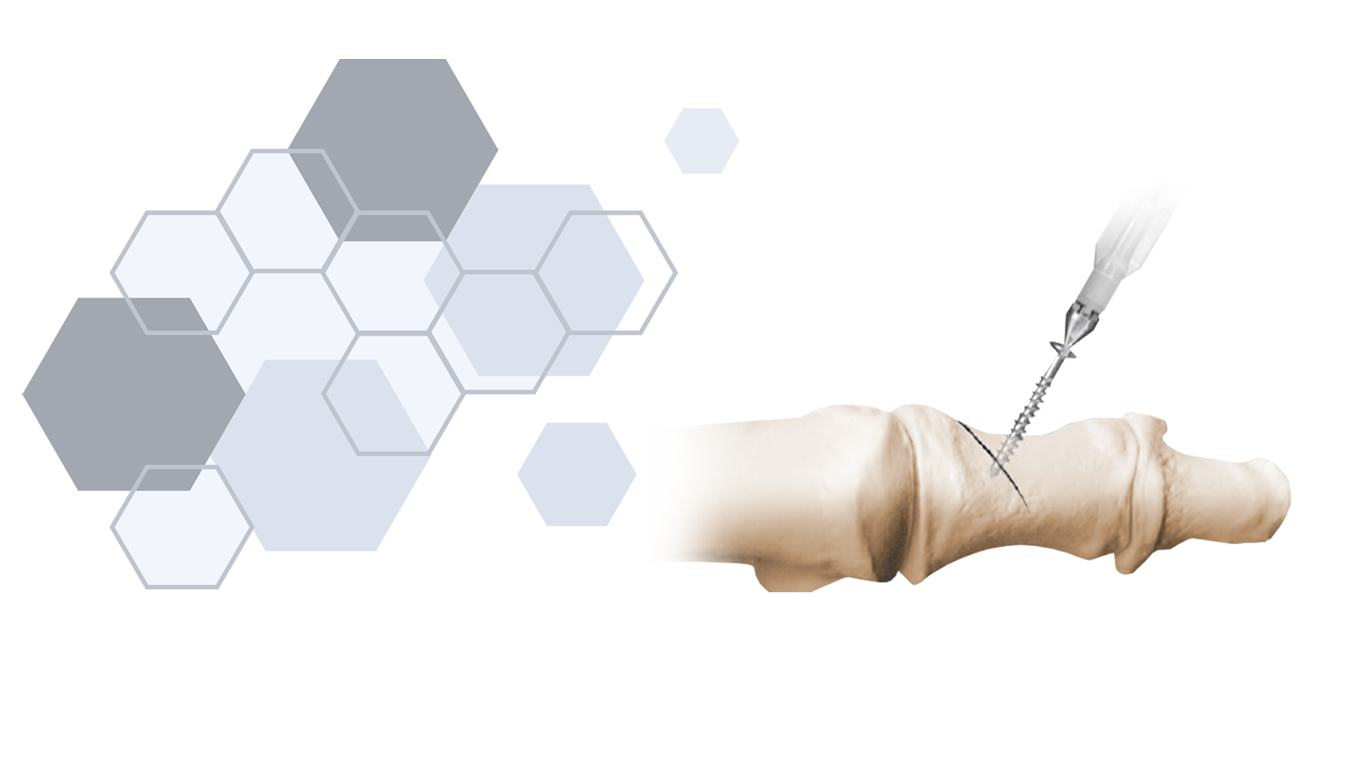 NeoSys Single-Use Instruments | CONMED